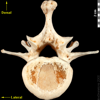 Bone Viewer | eSkeletons