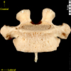 Bone Viewer | eSkeletons
