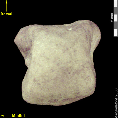 Bone Viewer | eSkeletons