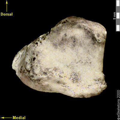 Bone Viewer | eSkeletons