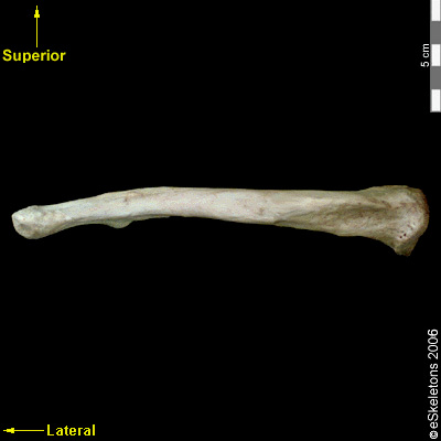 Bone Viewer | eSkeletons