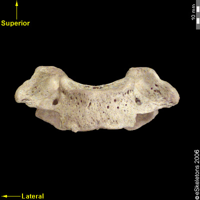 Bone Viewer | eSkeletons