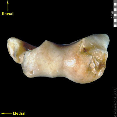 Bone Viewer | eSkeletons